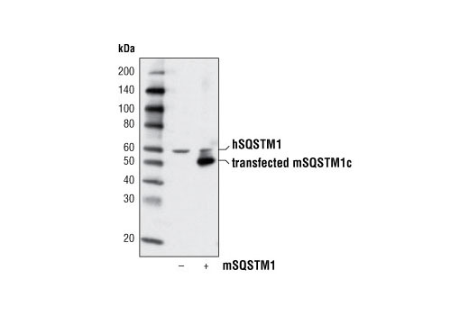 SQSTM1/p62 Antibody #5114-Cell Signaling Technology SQSTM1/p62 Antibody #5114-Cell Signaling Technology