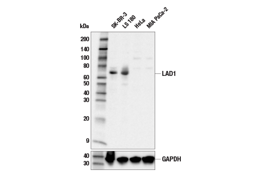 LAD1 (E3Q8E) Rabbit mAb (#76163) Datasheet With Images | Cell Signaling ...
