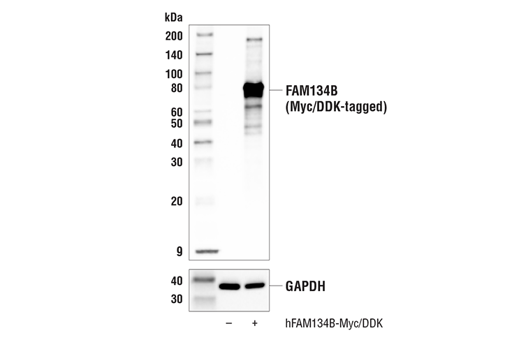 FAM134B (E8Y9R) Rabbit mAb (#83414) Datasheet With Images | Cell ...