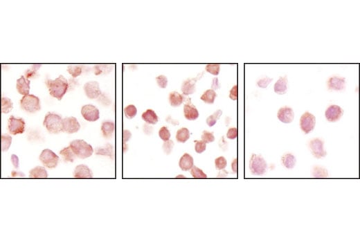 PhosphoPlus® Notch1 (Cleaved, Val1744) Antibody Duet (#8216) Datasheet With Images | Cell ...