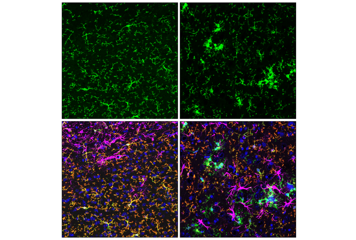 HS1 (E6G7M) Mouse mAb (#16621) Datasheet With Images | Cell Signaling ...