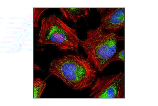 CST | Cell Signaling Technology