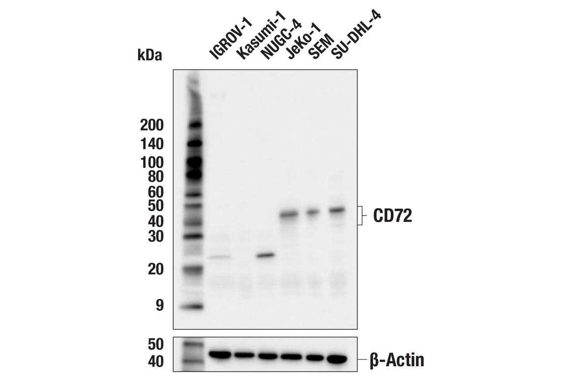 CD72 (E7Q7W) Rabbit mAb | Cell Signaling Technology