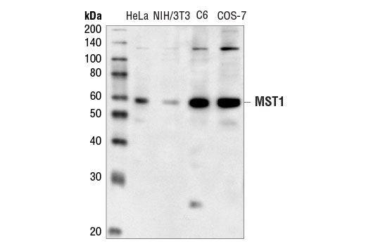 MST1 Antibody | Cell Signaling Technology