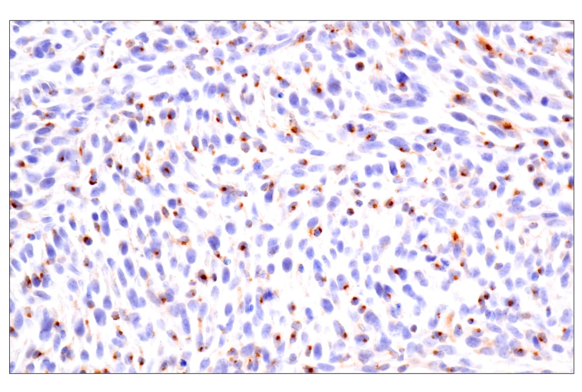 LAPTM5 (E7D5O) Rabbit mAb (#83820) Datasheet With Images | Cell ...