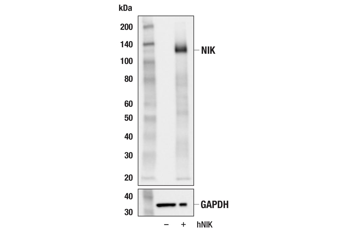 NIK (E5S4V) Rabbit mAb (#86473) Datasheet With Images | Cell Signaling ...