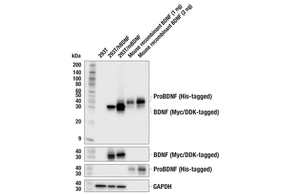BDNF (E6Z7C) Rabbit mAb (#16696) Datasheet With Images | Cell Signaling ...