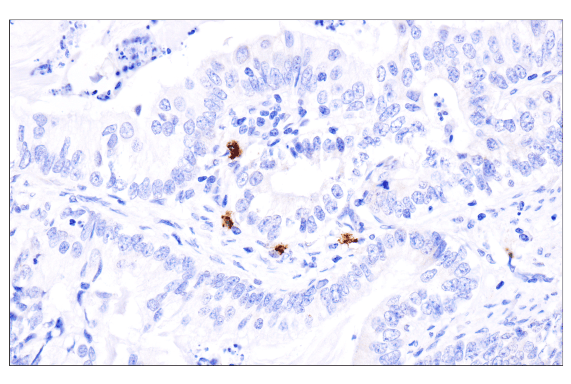 Mast Cell Chymase/CMA1 (F6S4Q) Rabbit mAb (#18992) Datasheet With ...
