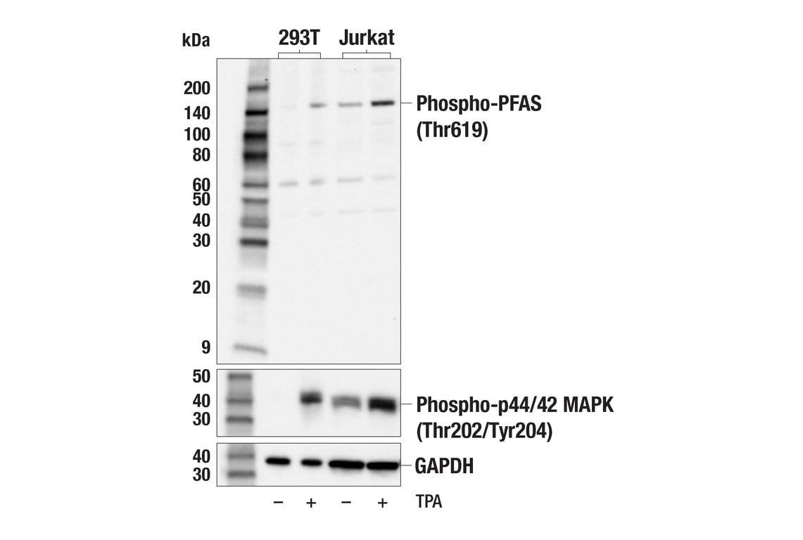 Phospho-PFAS (Thr619) (F1L7L) Rabbit mAb (#75628) Datasheet With Images | Cell Signaling Technology