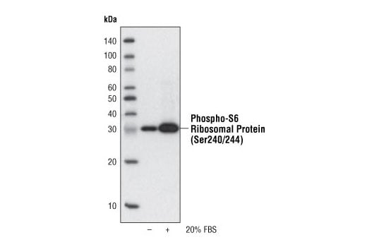 Phospho-S6 Ribosomal Protein (Ser240/244) (61H9) Rabbit mAb ...