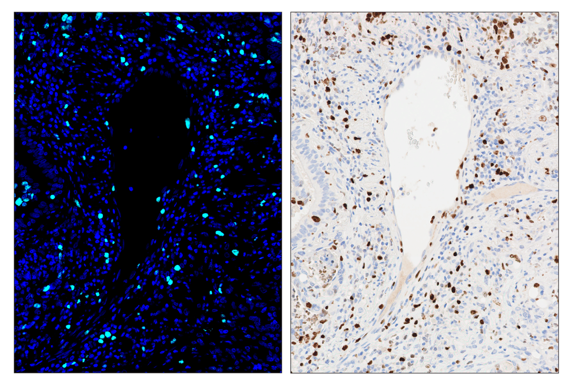 SignalStar™ Miniplex IHC Buffer Kit (#63043) Datasheet With Images | Cell Signaling Technology