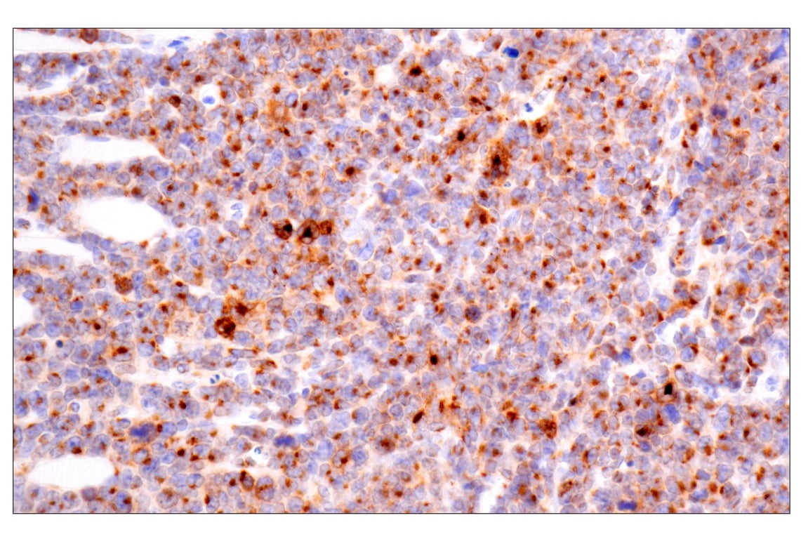 LAPTM5 (E7D5O) Rabbit mAb (#83820) Datasheet With Images | Cell ...
