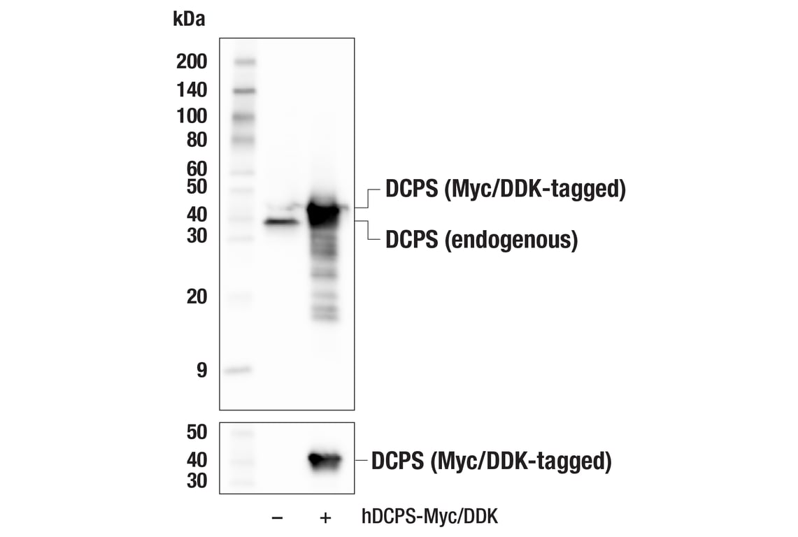 DCPS (E3A4Q) Rabbit Monoclonal Antibody (#70542) Datasheet With Images ...