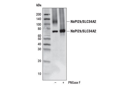 NaPi2b/SLC34A2 (D3V3I) Rabbit mAb (#66445) Datasheet With Images | Cell Signaling Technology