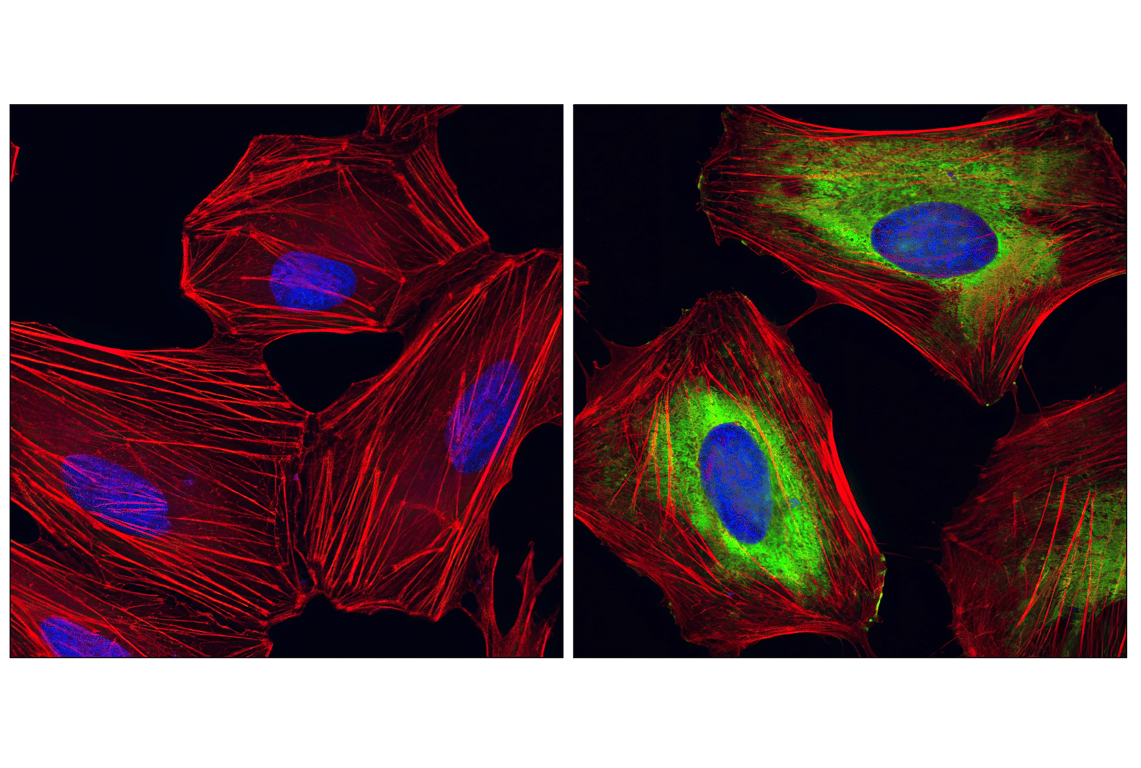 PhosphoPlus® S6 Ribosomal Protein (Ser235/Ser236) Antibody Duet (#8207) Datasheet With Images ...
