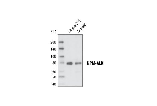ALK Antibody Sampler Kit (#12645) Datasheet With Images | Cell ...