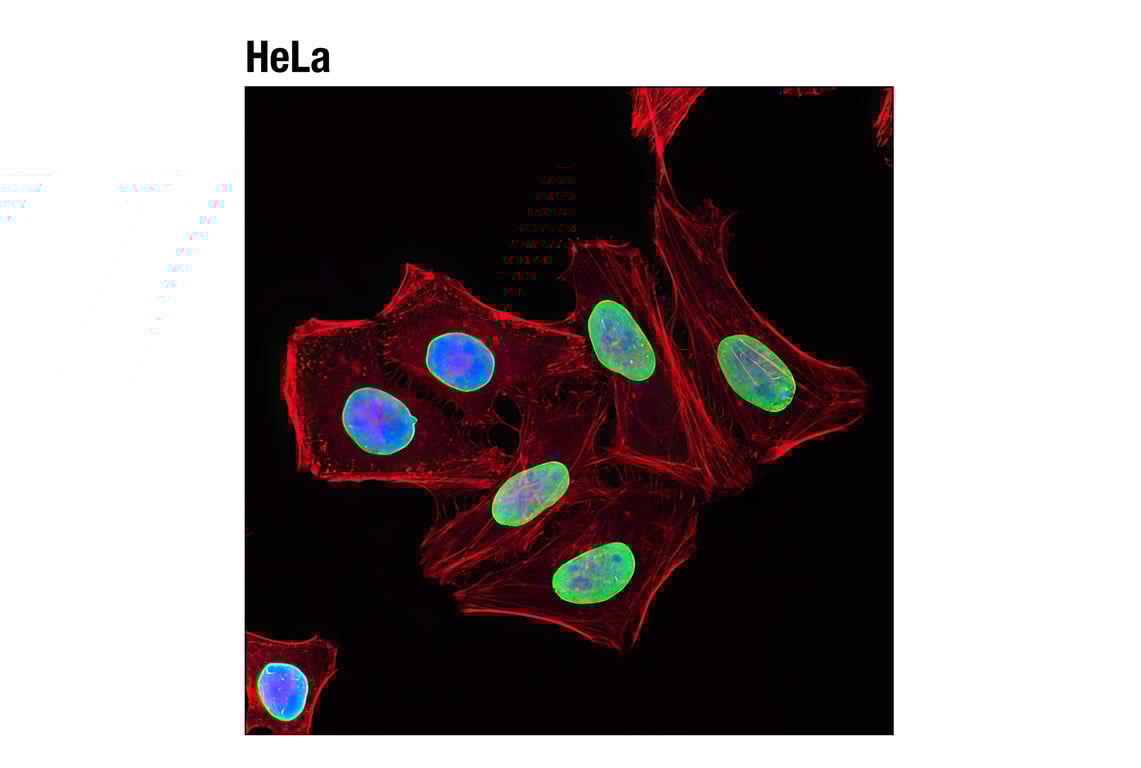 DyLight 594 Phalloidin | Cell Signaling Technology
