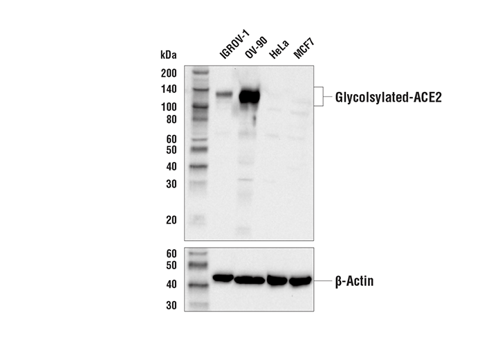 ACE2 Antibody | COVID-19 Research | Cell Signaling Technology