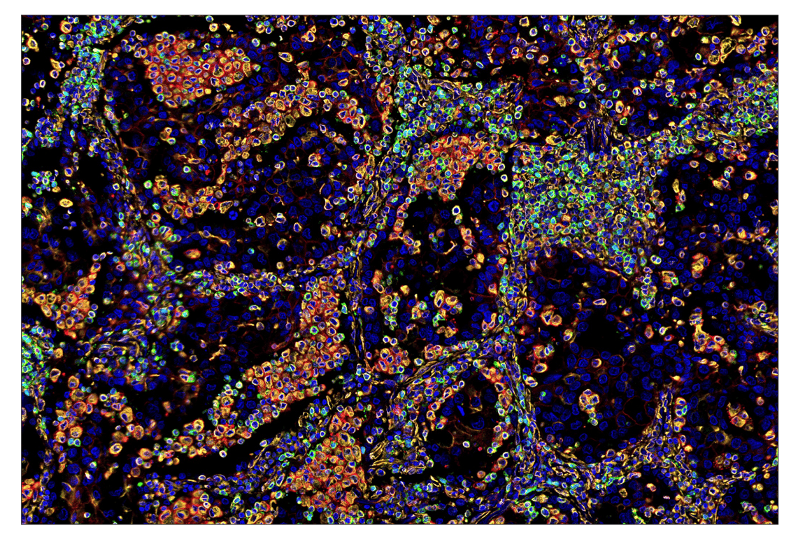 SignalStar™ Miniplex IHC Buffer Kit | Cell Signaling Technology