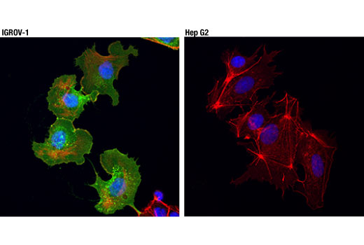 NaPi2b/SLC34A2 (D3V3I) Rabbit mAb (#66445) Datasheet With Images | Cell Signaling Technology