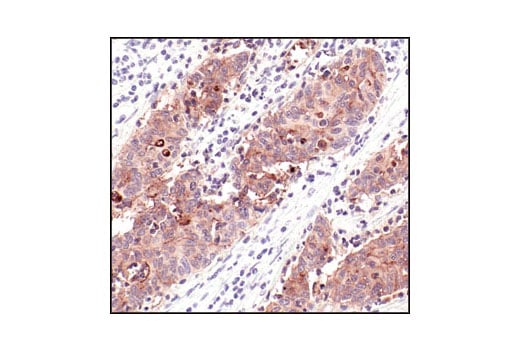 CEA/CD66e (CB30) Mouse mAb (BSA and Azide Free) (#42738) Datasheet With ...