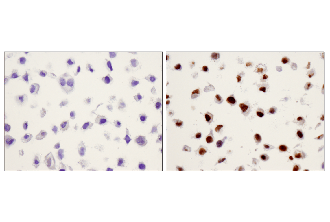 Phospho-Stat3 (Tyr705) (D3A7) XP® Rabbit mAb (#9145) Datasheet With ...