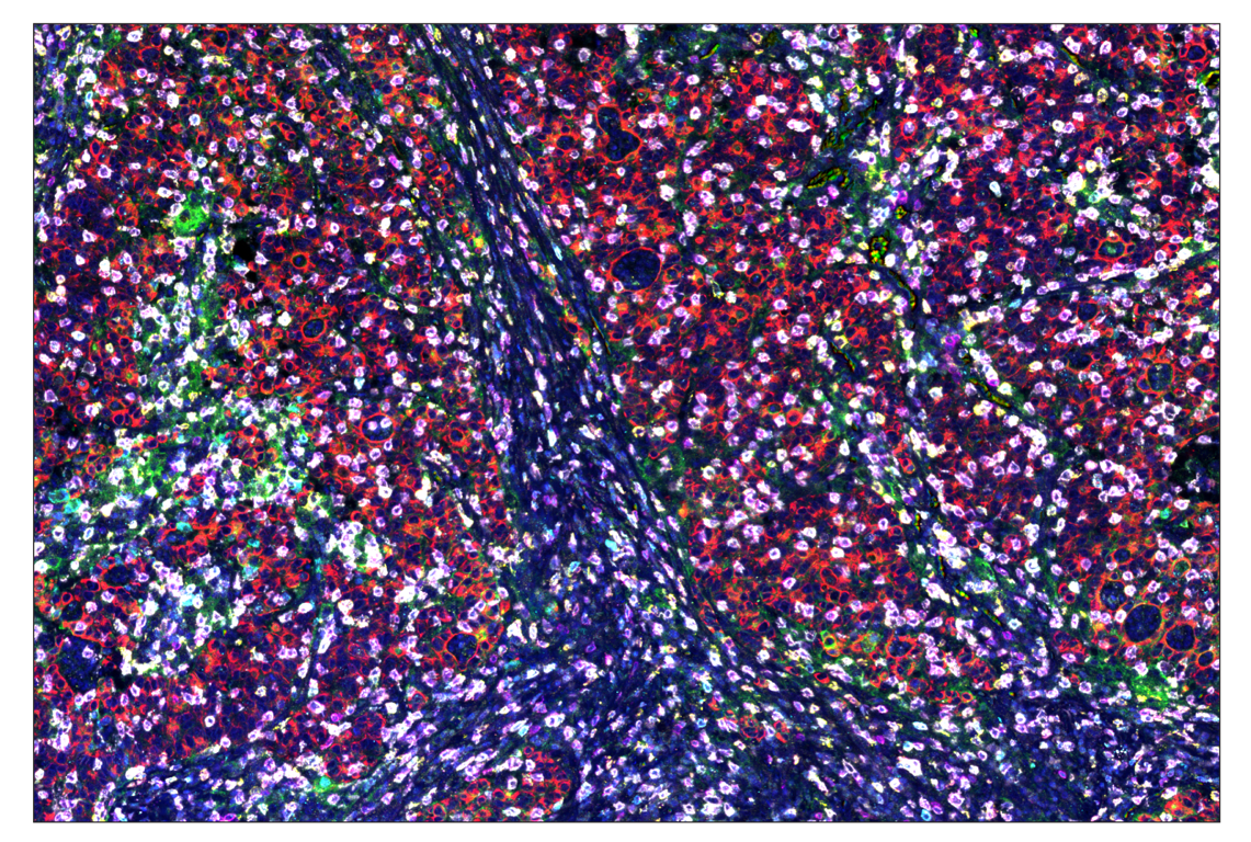 SignalStar™ Midplex IHC Buffer Kit | Cell Signaling Technology