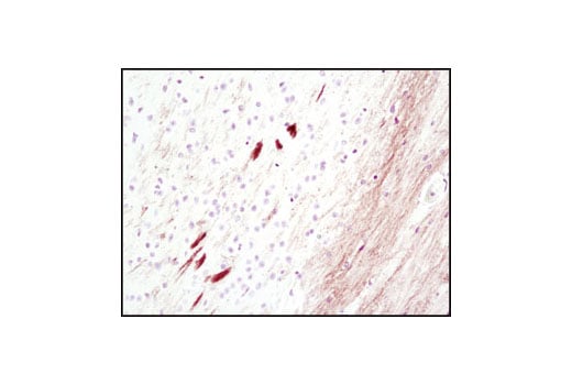 DARPP-32 (19A3) Rabbit mAb (#2306) Datasheet With Images | Cell ... DARPP-32 (19A3) Rabbit mAb (#2306) Datasheet With Images | Cell ...