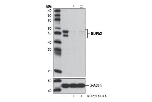 SignalSilence® NDP52 siRNA I | Cell Signaling Technology