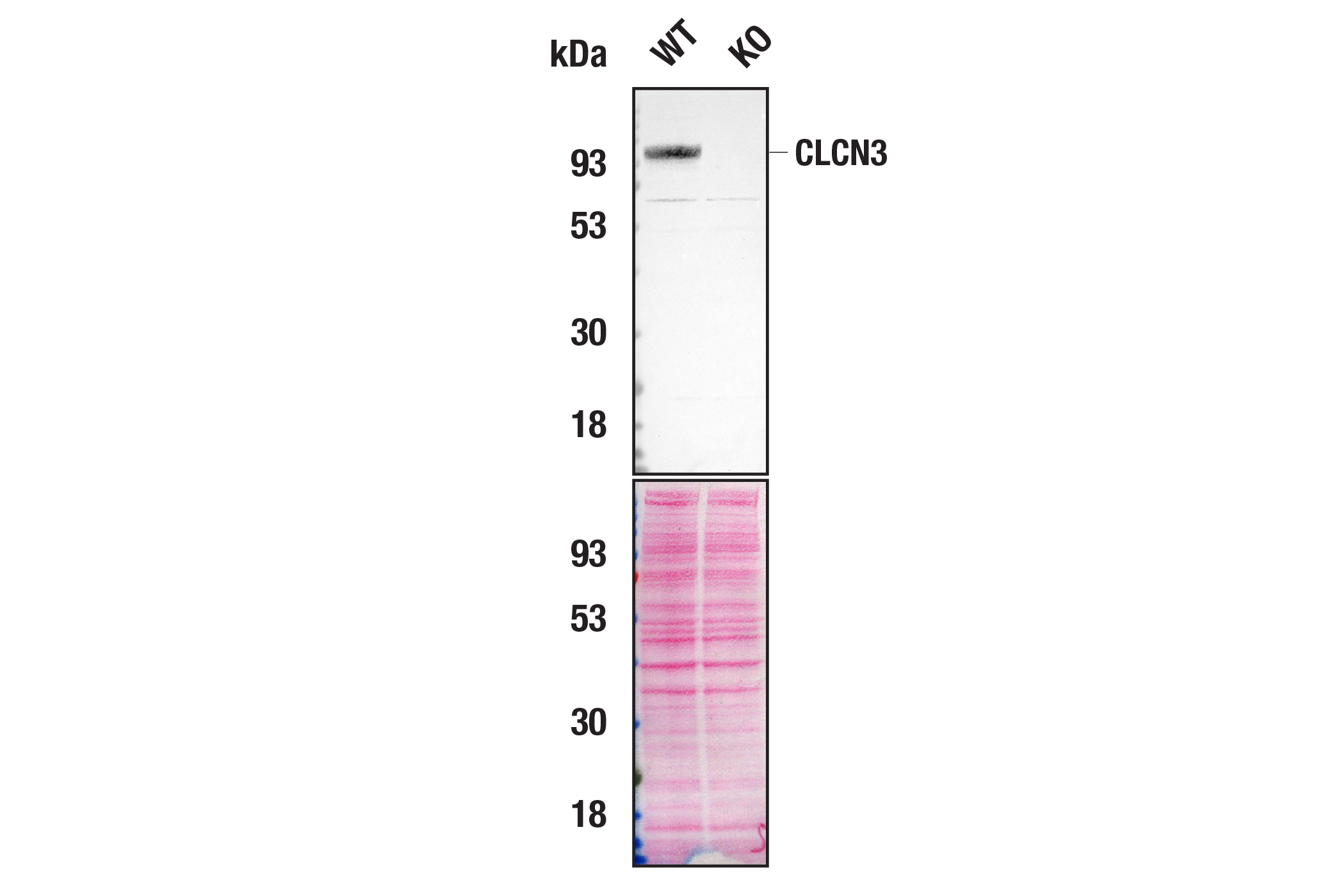 CLCN3 (D8Y5Q) Rabbit Monoclonal Antibody (#13359) Datasheet With Images ...