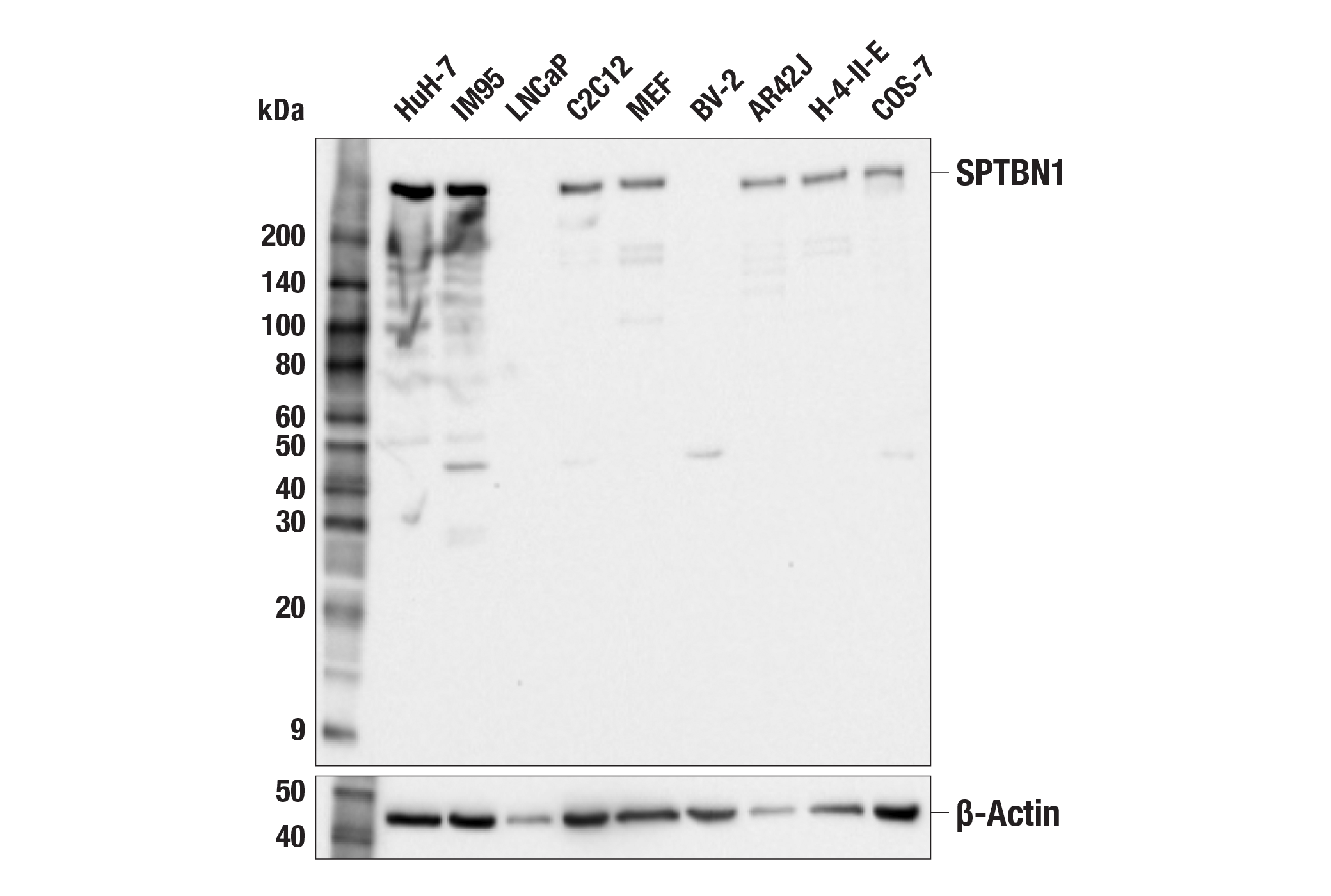 SPTBN1 (F9M4B) Rabbit mAb | Cell Signaling Technology