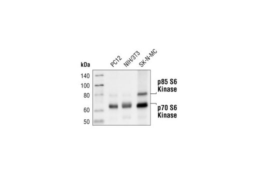 Phospho-p70 S6 Kinase (Thr389) Antibody | Cell Signaling Technology