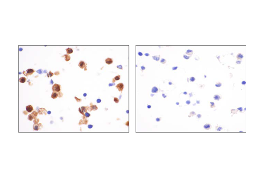 PhosphoPlus® p70 S6 Kinase (Thr389) Antibody Duet | Cell Signaling Technology