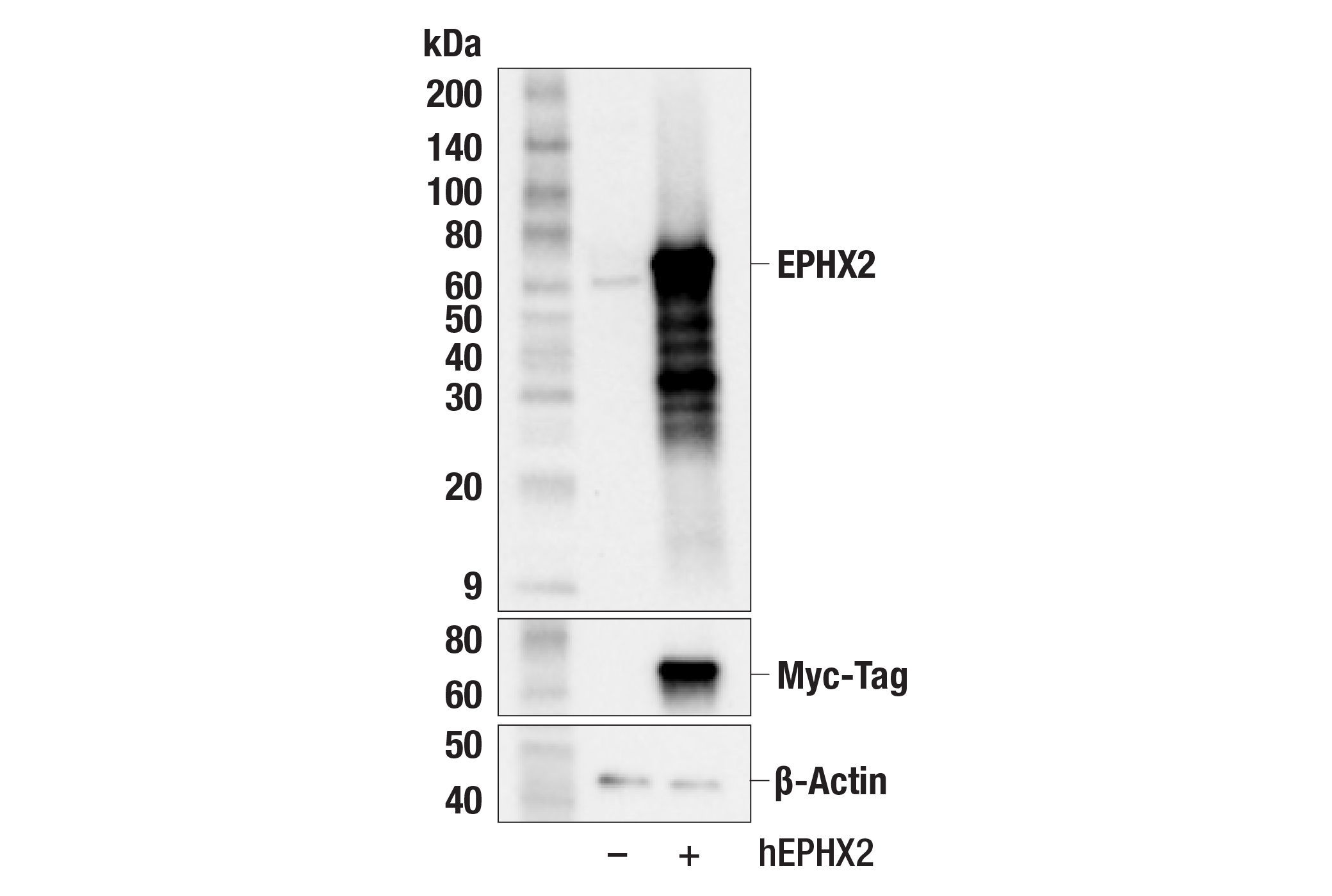 EPHX2 (F9Z3M) Rabbit mAb | Cell Signaling Technology
