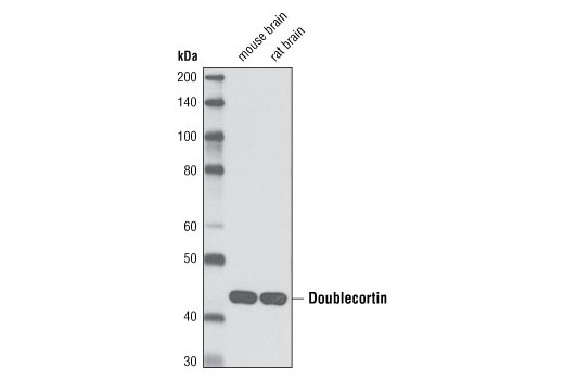 Doublecortin (D7E4) Rabbit mAb | Cell Signaling Technology