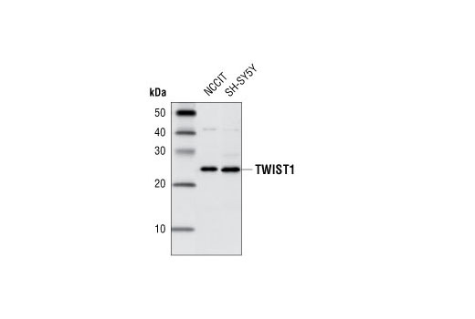 TWIST1 Antibody | Cell Signaling Technology