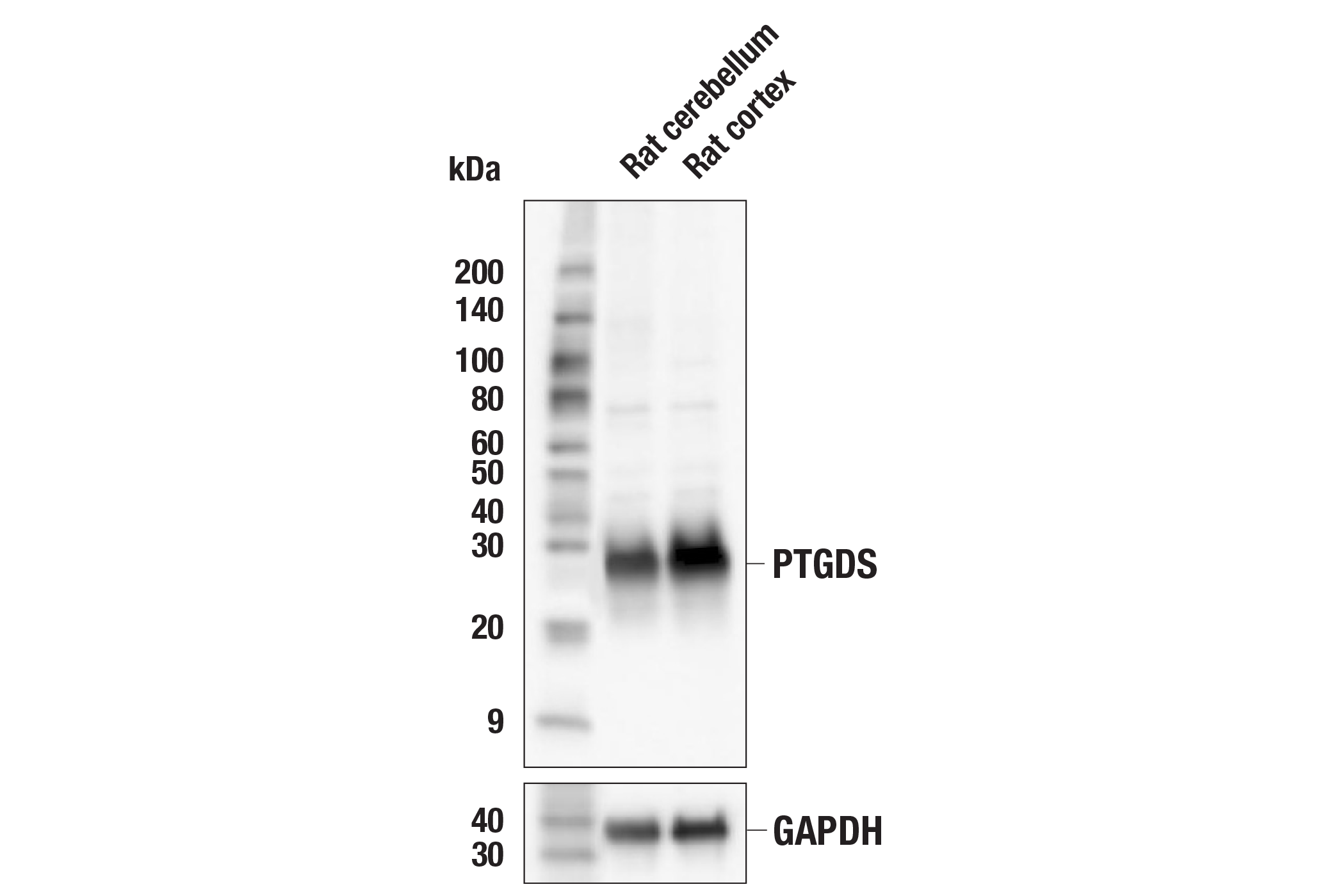 PTGDS (F5R5O) Rabbit mAb | Cell Signaling Technology