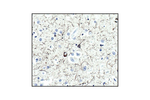 Tau (Tau46) Mouse mAb (BSA and Azide Free) | Cell Signaling Technology