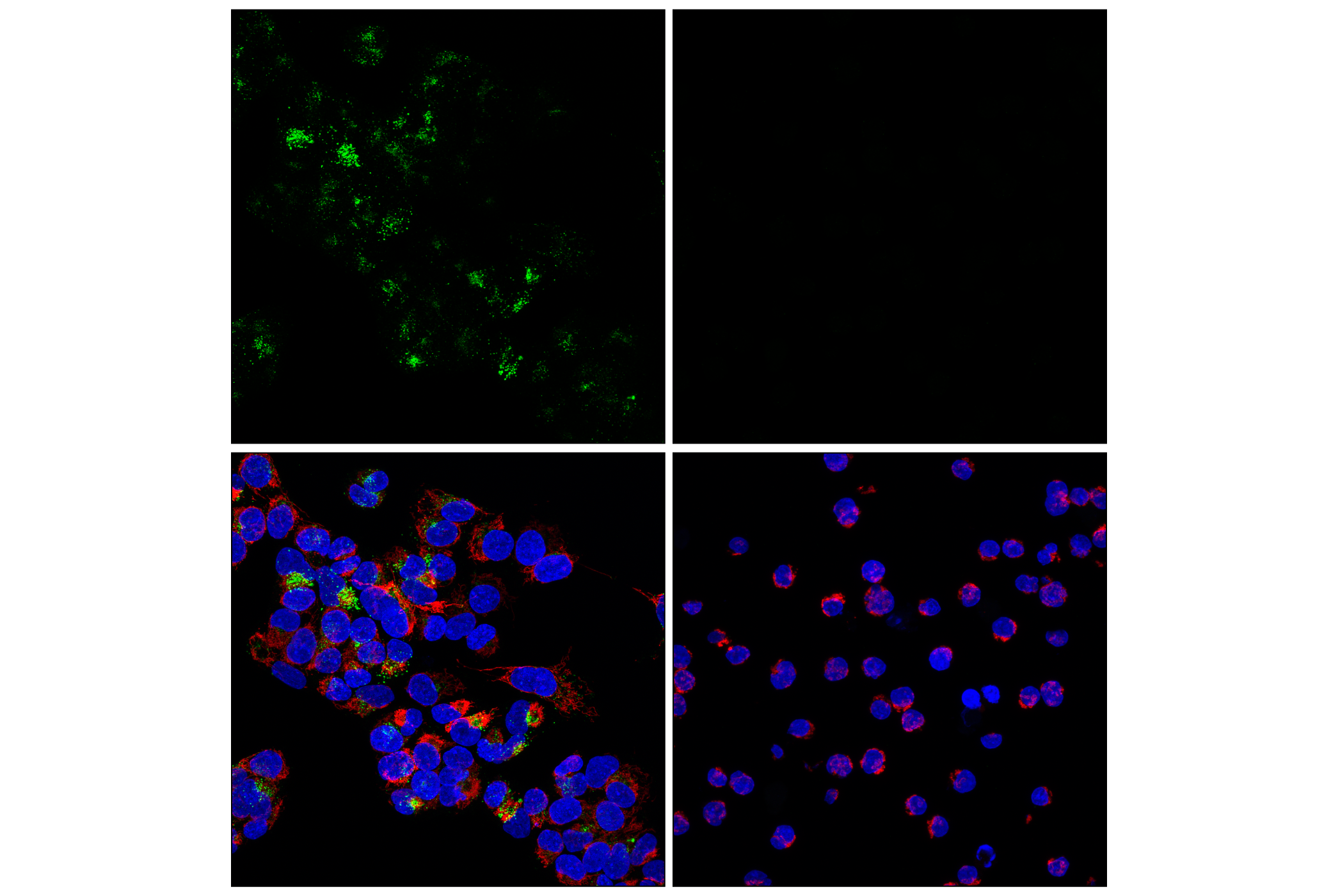 ITM2C/Bri3 (F3X8Z) Rabbit mAb | Cell Signaling Technology