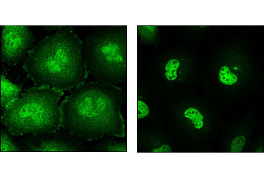 PhosphoPlus® Stat3 (Tyr705) Antibody Kit | Cell Signaling Technology