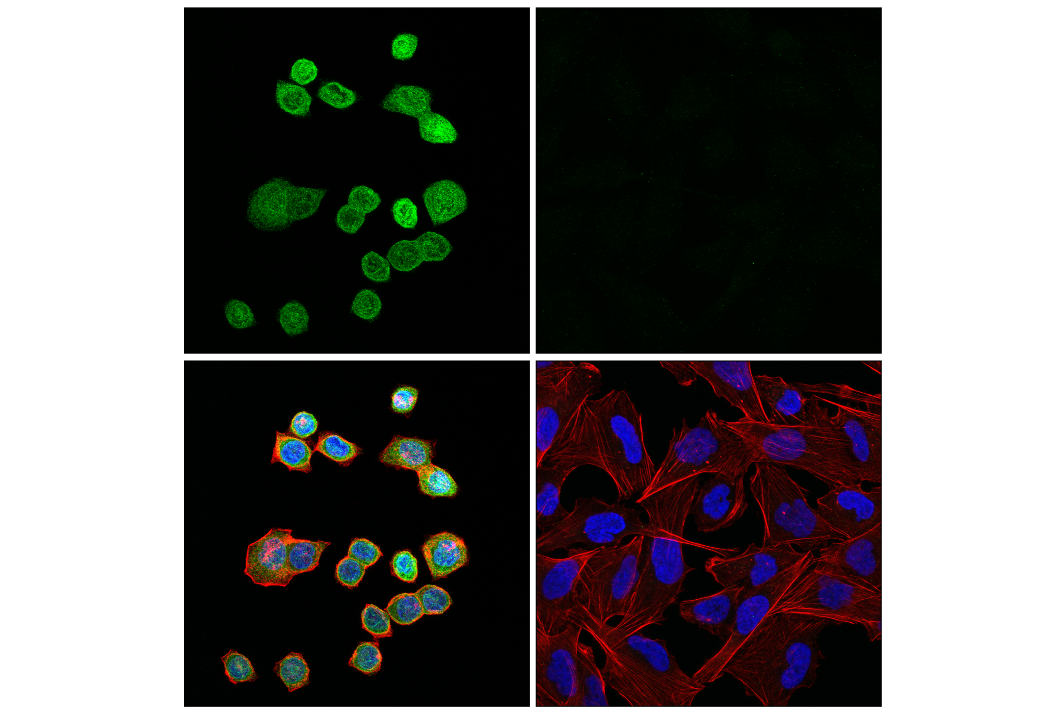 UNC93B1 (E5H3O) Rabbit mAb | Cell Signaling Technology