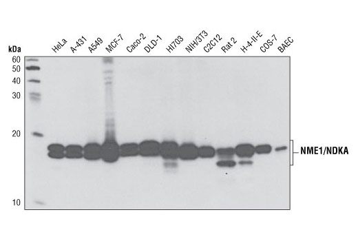 NME1/NDKA (G19) Antibody | Cell Signaling Technology