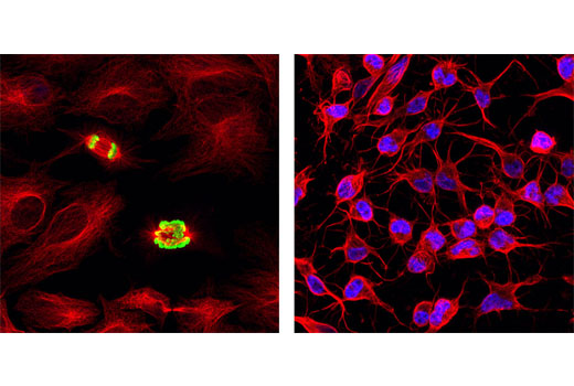 CST - PathScan® Apoptosis and Proliferation Multiplex IF Kit