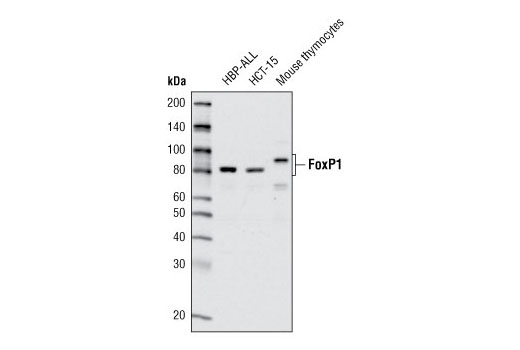 FoxP1 Antibody_报价/价格/性能参数/图, 美国/CST_生物器材网