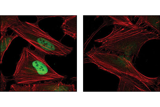 HIF1-alpha Antibodies for Hamster | AntibodyResource.com