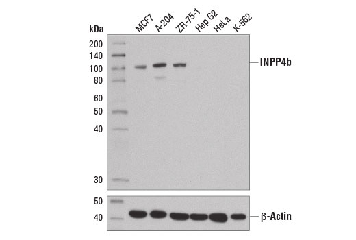 ITPK1 Antibody | Cell Signaling Technology