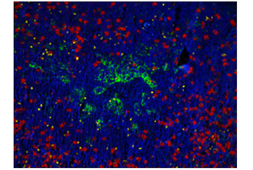 CST - PD-L1, FoxP3, CD8α Multiplex IHC Antibody Panel