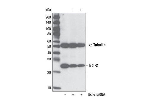 Pro-Survival Bcl-2 Family Antibody Sampler Kit #9941-Cell Signaling ...